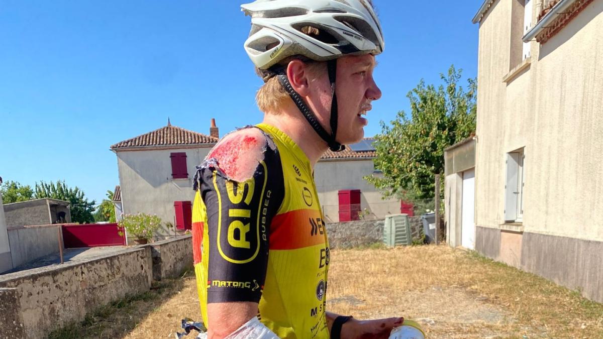 Wielrenner Pim Fransen wordt na flinke val 'de mummie' genoemd - NH Nieuws